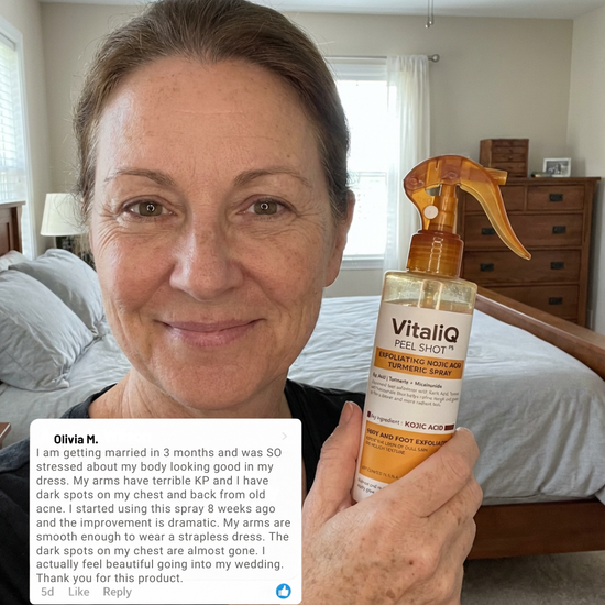Kojic Acid Turmeric spray - Dark Spot Formula – VitaliQ